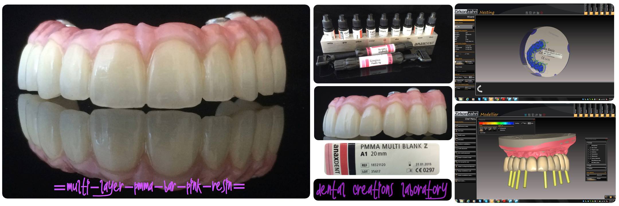 Dental Creations Lab
